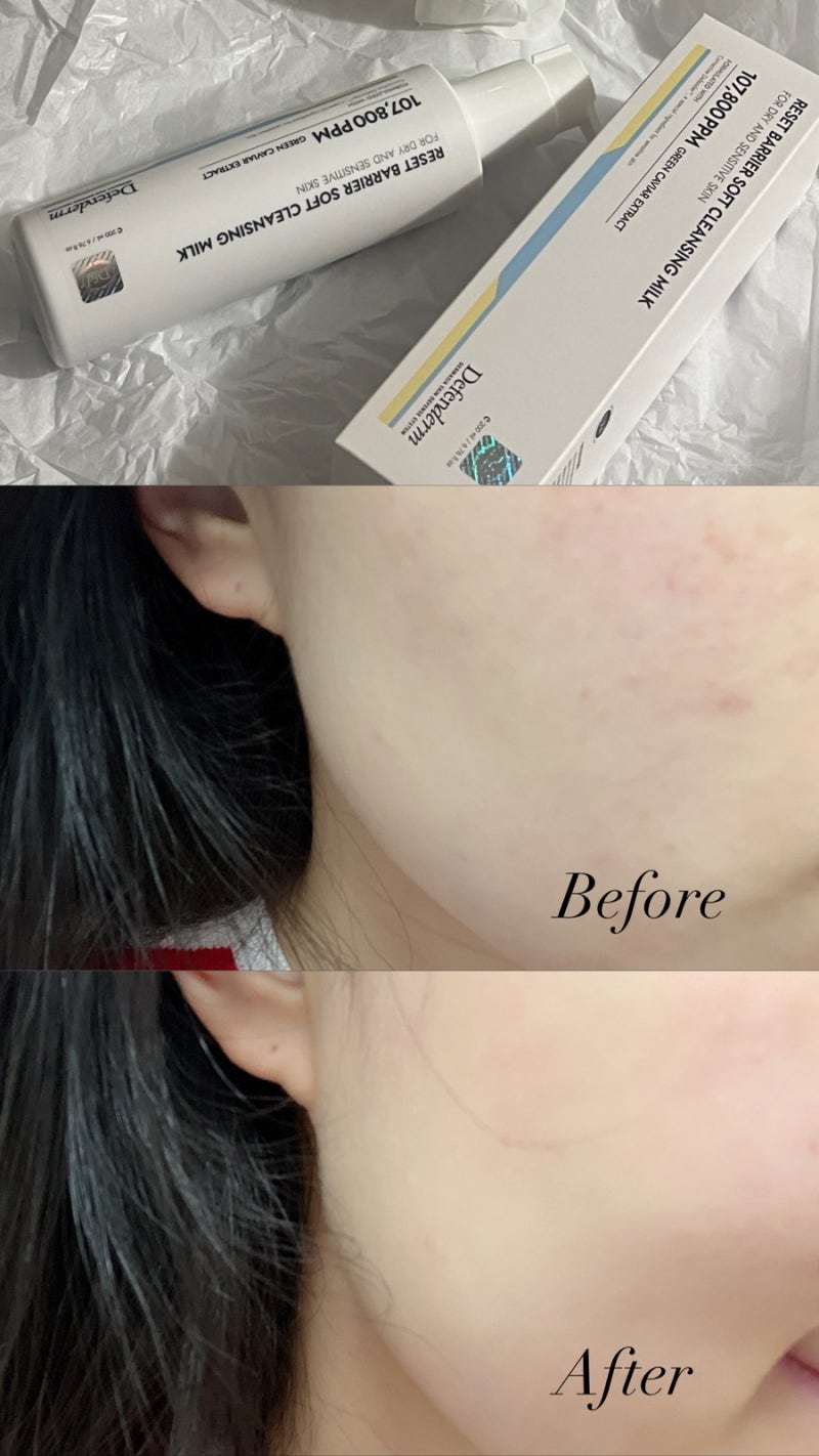 민감성 피부 아침세안제 추천 디펜덤 클렌징밀크 네이버 블로그