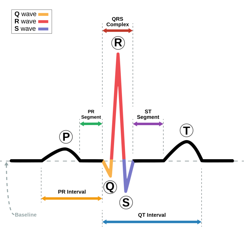 STEMI와 NSTEMI (심근경색, myocardial infarction) : 네이버 블로그