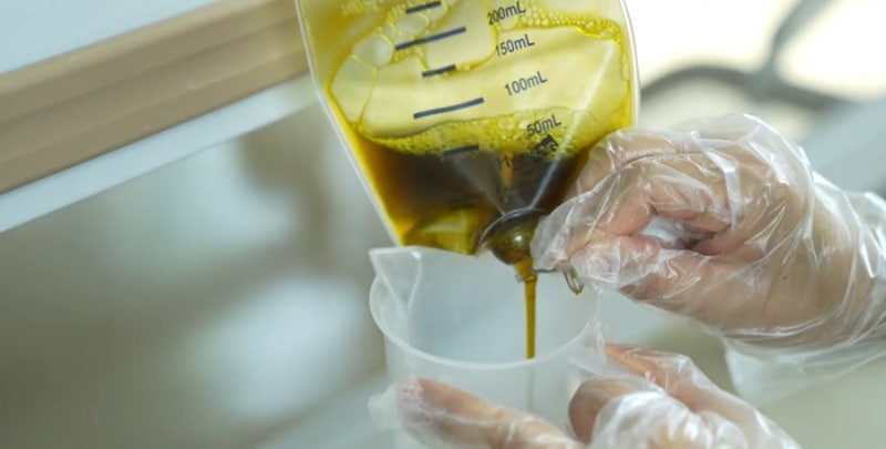 PTBD PTGBD 간호, irrigation, 관리방법 : 네이버 블로그