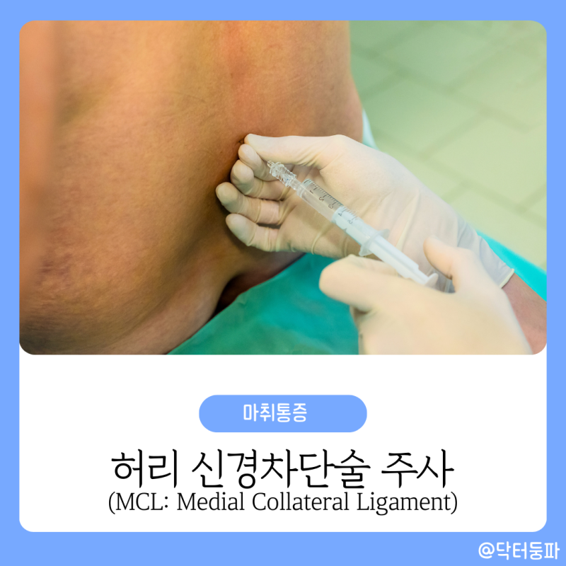 허리 신경차단술 주사 비용 효과 및 부작용 네이버 블로그
