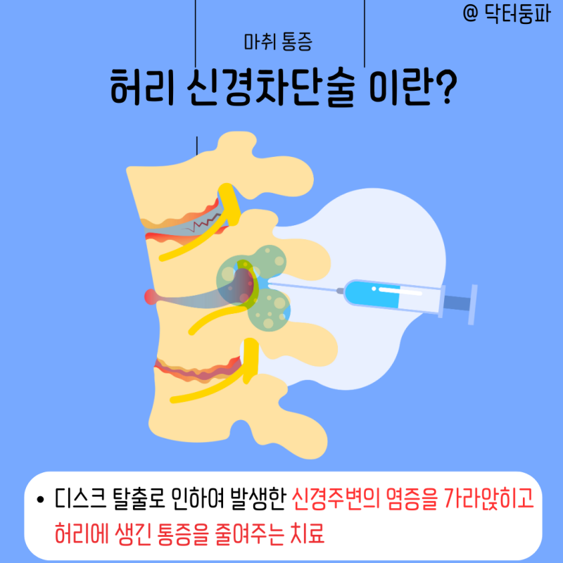 허리 신경차단술 주사 비용 효과 및 부작용 네이버 블로그