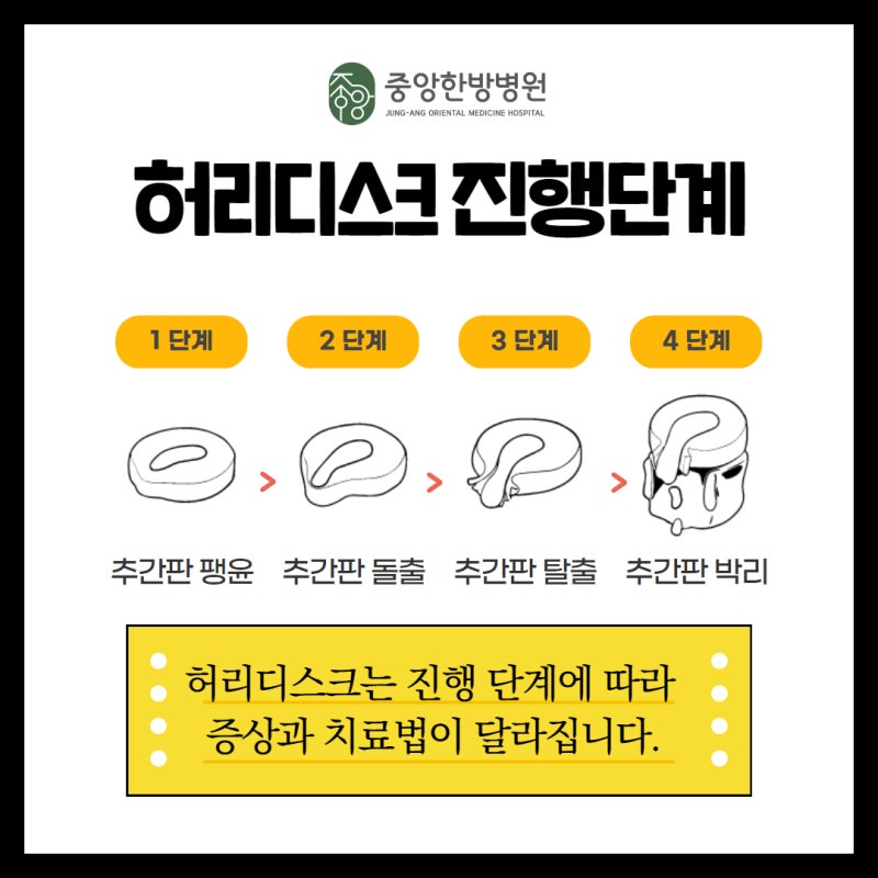허리디스크 단계별 증상과 한의학 의학 협진 비수술 치료법 네이버 블로그