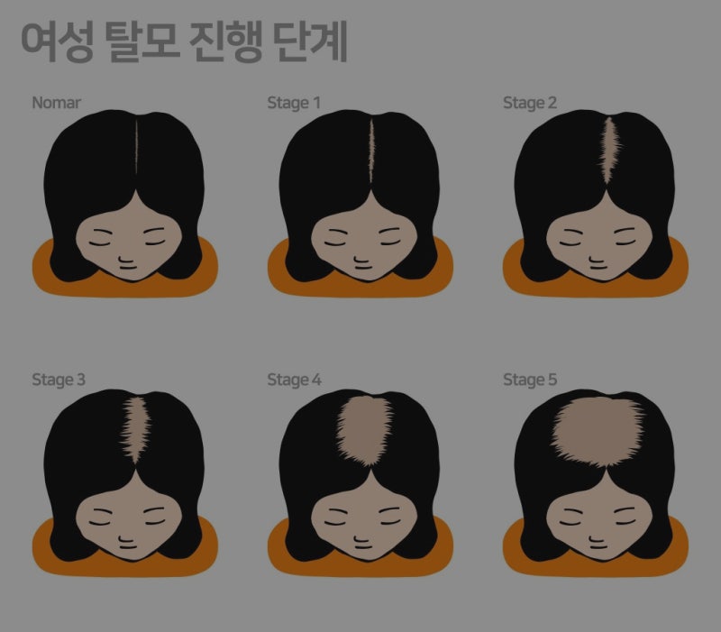 탈모 영양제 비오틴 하루 권장량과 고르는 방법 네이버 블로그