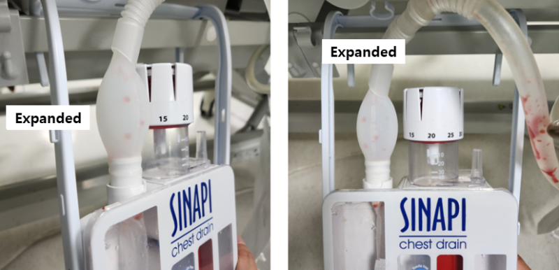 [중환자 모니터링] SINAPI chest bottle : 네이버 블로그