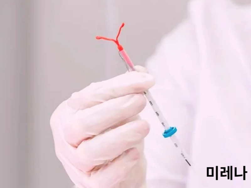 임플라논 원리 효과 시술 절차 피임 지속 기간 부작용 가격 네이버 블로그