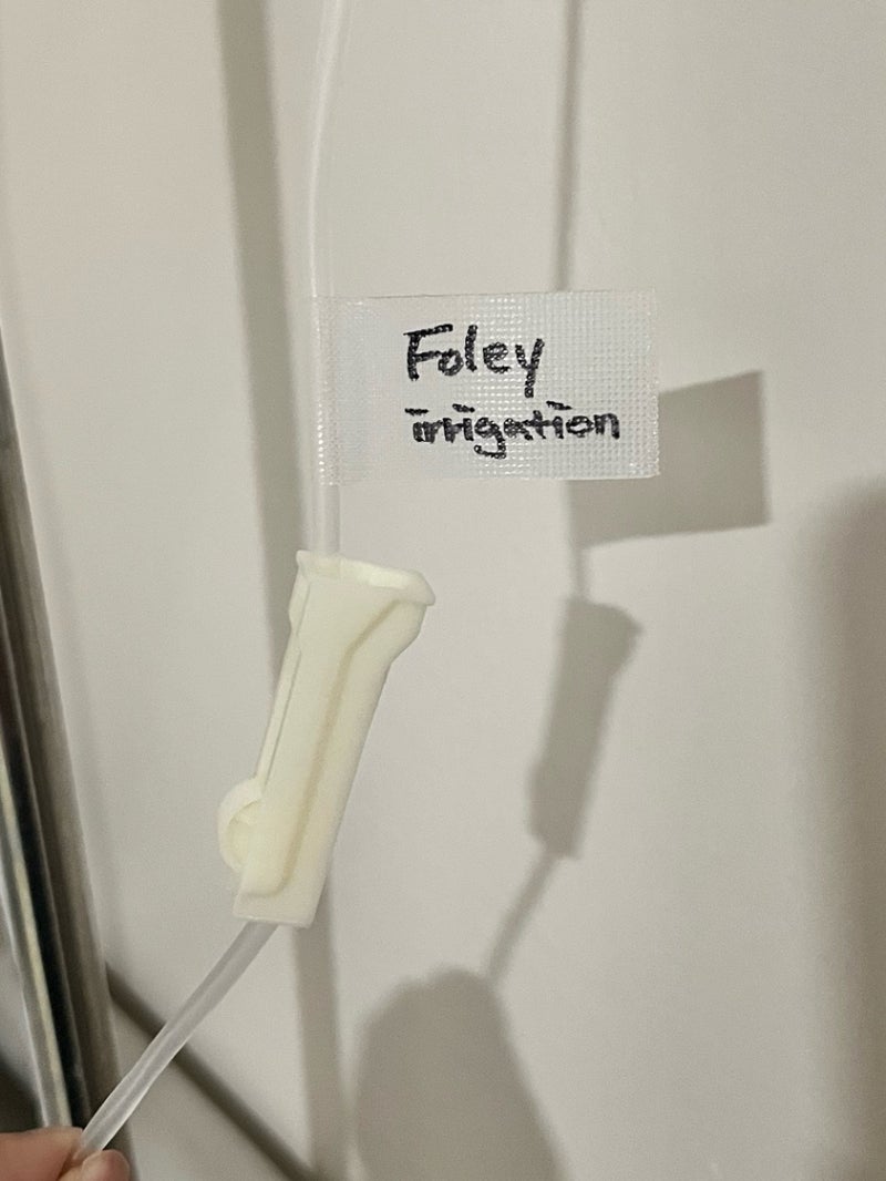 foley ballooning irrigation leakage 공부해보자 : 네이버 블로그