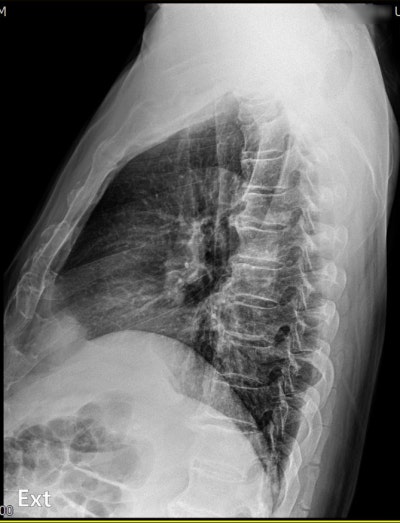 영상의학과 일반촬영 시리즈 X-Ray Series(SKULL,PNS,MANDIBLE,CTL-SPINE,SACRUM,COCCYX ...
