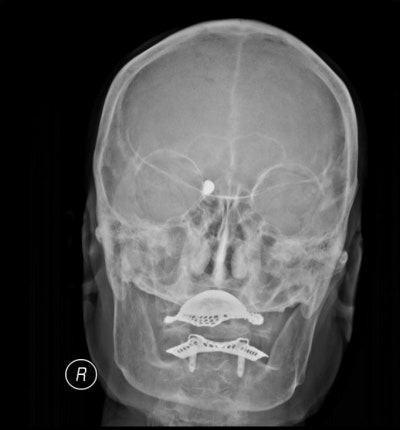 영상의학과 일반촬영 시리즈 X-Ray Series(SKULL,PNS,MANDIBLE,CTL-SPINE,SACRUM,COCCYX ...