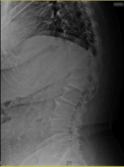 영상의학과 일반촬영 시리즈 X-Ray Series(SKULL,PNS,MANDIBLE,CTL-SPINE,SACRUM,COCCYX ...