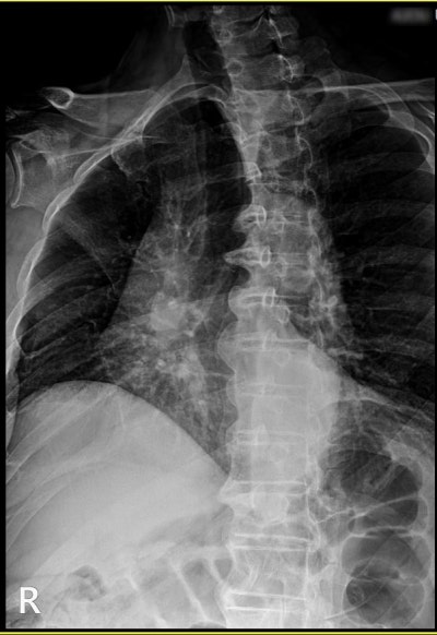 영상의학과 일반촬영 시리즈 X-Ray Series(SKULL,PNS,MANDIBLE,CTL-SPINE,SACRUM,COCCYX ...