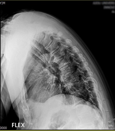 영상의학과 일반촬영 시리즈 X-Ray Series(SKULL,PNS,MANDIBLE,CTL-SPINE,SACRUM,COCCYX ...