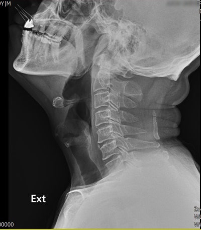영상의학과 일반촬영 시리즈 X-Ray Series(SKULL,PNS,MANDIBLE,CTL-SPINE,SACRUM,COCCYX ...
