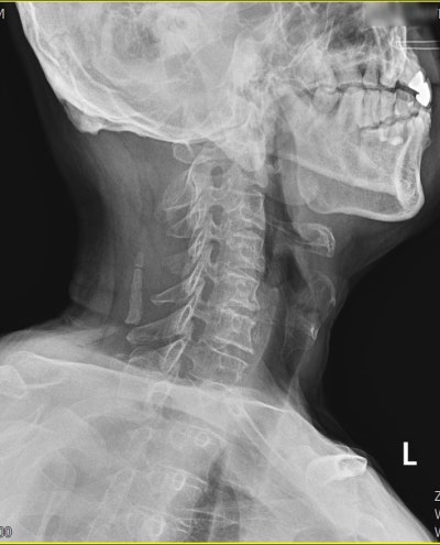 영상의학과 일반촬영 시리즈 X-Ray Series(SKULL,PNS,MANDIBLE,CTL-SPINE,SACRUM,COCCYX ...