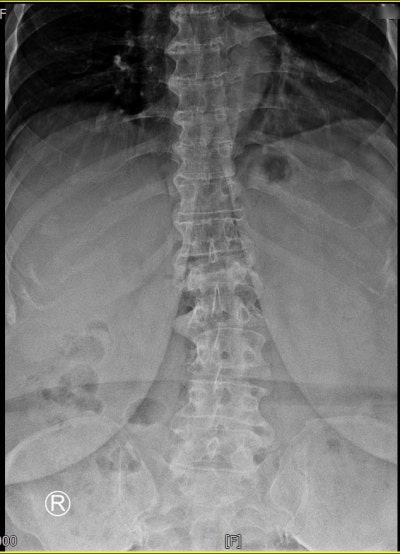 영상의학과 일반촬영 시리즈 X-Ray Series(SKULL,PNS,MANDIBLE,CTL-SPINE,SACRUM,COCCYX ...