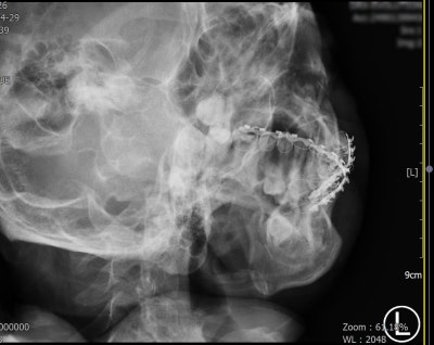 영상의학과 일반촬영 시리즈 X-Ray Series(SKULL,PNS,MANDIBLE,CTL-SPINE,SACRUM,COCCYX ...
