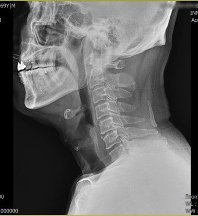 영상의학과 일반촬영 시리즈 X-Ray Series(SKULL,PNS,MANDIBLE,CTL-SPINE,SACRUM,COCCYX ...