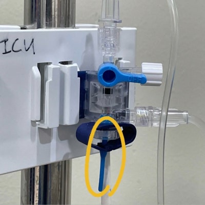 두개내압 모니터링(Intracranial pressure monitoring) : 네이버 블로그
