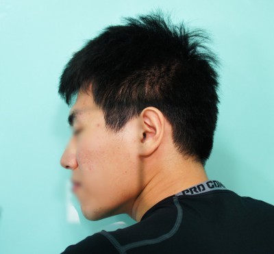 영상의학과 일반촬영 시리즈 X-Ray Series(SKULL,PNS,MANDIBLE,CTL-SPINE,SACRUM,COCCYX ...