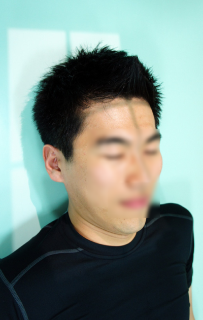 영상의학과 일반촬영 시리즈 X-Ray Series(SKULL,PNS,MANDIBLE,CTL-SPINE,SACRUM,COCCYX ...