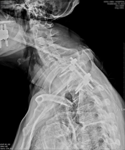 영상의학과 일반촬영 시리즈 X-Ray Series(SKULL,PNS,MANDIBLE,CTL-SPINE,SACRUM,COCCYX ...