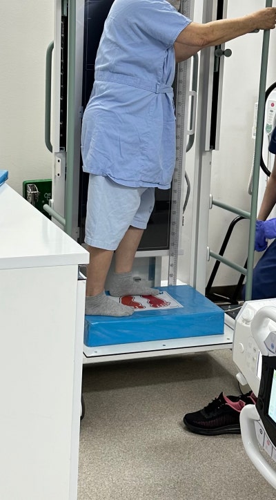 Knee AP,PA,ROSENBERG(Both Lat, Merchant)촬영법 무릎관절 X-RAY검사법 소개 : 네이버 블로그