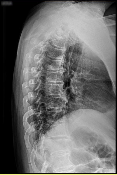 영상의학과 일반촬영 시리즈 X-Ray Series(SKULL,PNS,MANDIBLE,CTL-SPINE,SACRUM,COCCYX ...