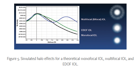 EDOF (Extended Depth of Focus) IOL: 초점심도연장 인공수정체의 정의 : 네이버 블로그