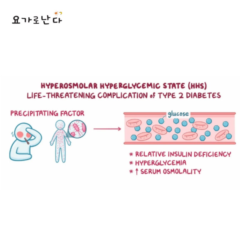 고혈당증hyperglycemia 합병증 당뇨병성 케톤산증과 고삼투압성고혈당상태 만성 고혈당증의 다양한 합병증