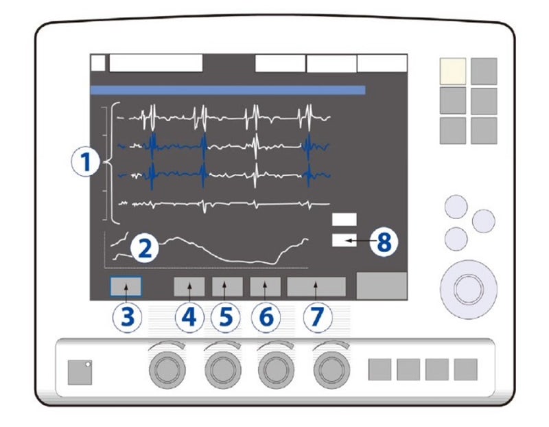 신생아 산소요법 정리(NP, HF, NCPAP, NIPPV, NAVA, HFV) : 네이버 블로그