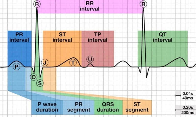 STEMI (급성 심근경색)의 정의, 치료법, EKG, NSTEMI의 차이점에 대해서 알아봐요~ : 네이버 블로그