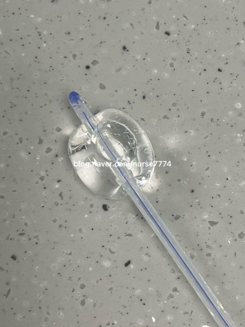 foley 2way 3way ballooning leakage 대처 방법 : 네이버 블로그