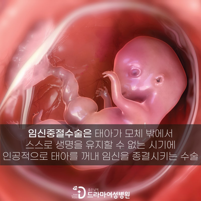 전문의와 상담 후 안전하게 결정 임신중절수술 좋은날에드라마여성병원 네이버 블로그