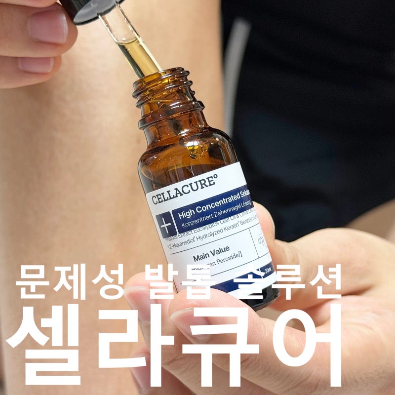 셀라큐어 문제성 발톱 솔루션 효과 발톱 무좀 약 2주 사용 후기 네이버 블로그