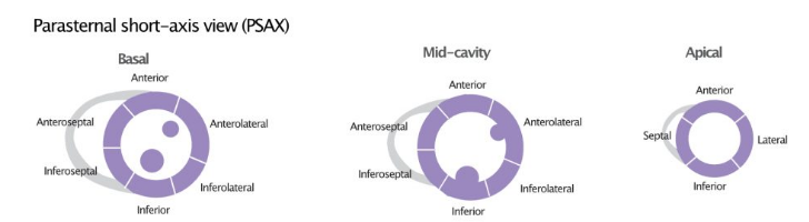 심장초음파 view 별 measure 측정 포인트, 정상 범위 : 네이버 블로그