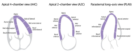 심장초음파 view 별 measure 측정 포인트, 정상 범위 : 네이버 블로그
