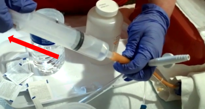 #8. 병동 신규간호사 (유치도뇨, foley catheter, irrigation) : 네이버 블로그