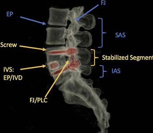 요추 CT xray 요추 엑스레이 검사 하는 이유, 장점과 단점 방법 각 영상 촬영 검사의 주의사항 및 부작용 까지 : 네이버 블로그