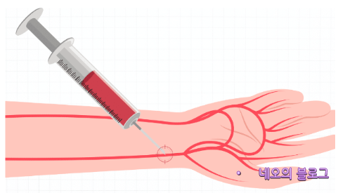 ABGA 정상수치 동맥혈가스분석 검사 주요 항목 정상 범위 : 네이버 블로그