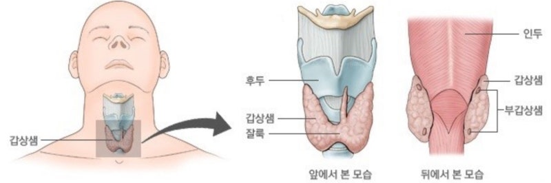 고칼슘혈증 원인 증상 치료 약물 네이버 블로그