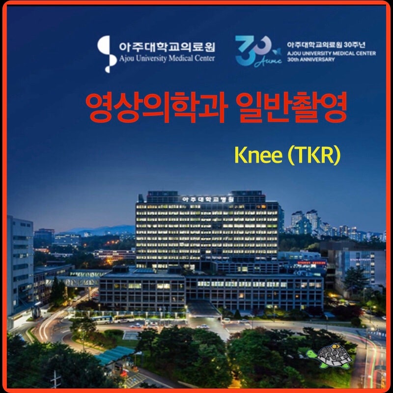 Knee AP,PA,ROSENBERG(Both Lat, Merchant)촬영법 무릎관절 X-RAY검사법 소개 : 네이버 블로그