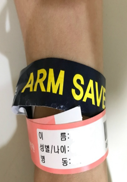 암세이브(arm save) 의미와 적용환자 / 혈액투석 통로와 카테터 / SVC syndrome / Hemiplegia ...