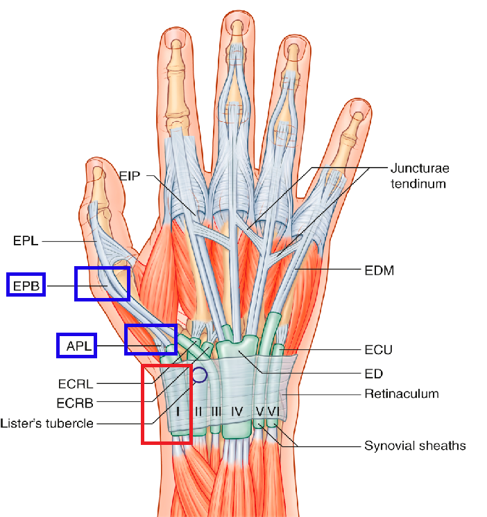 1. APL/EPB syndrome : De Quervain's disease : 네이버 블로그