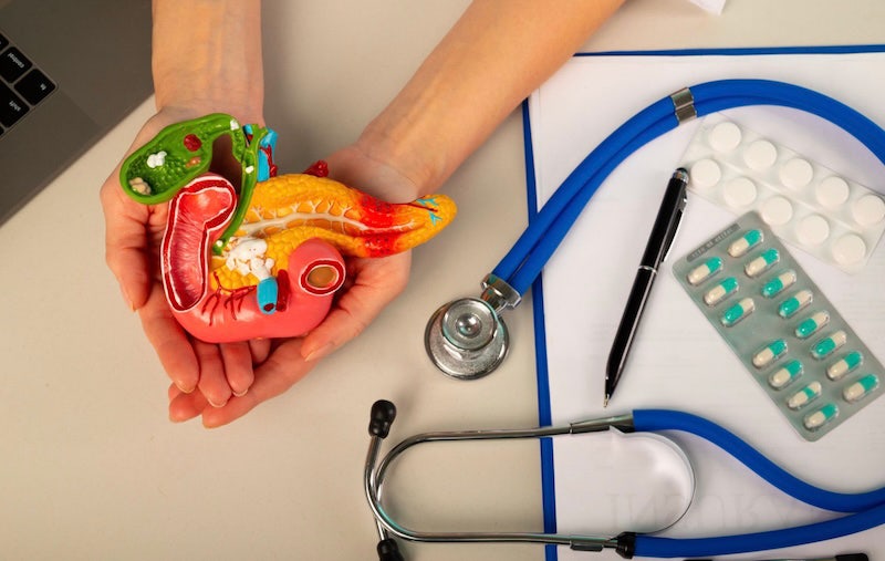 의학용어 ERBD 의미, 수술 방법, 간호 방법은? : 네이버 블로그