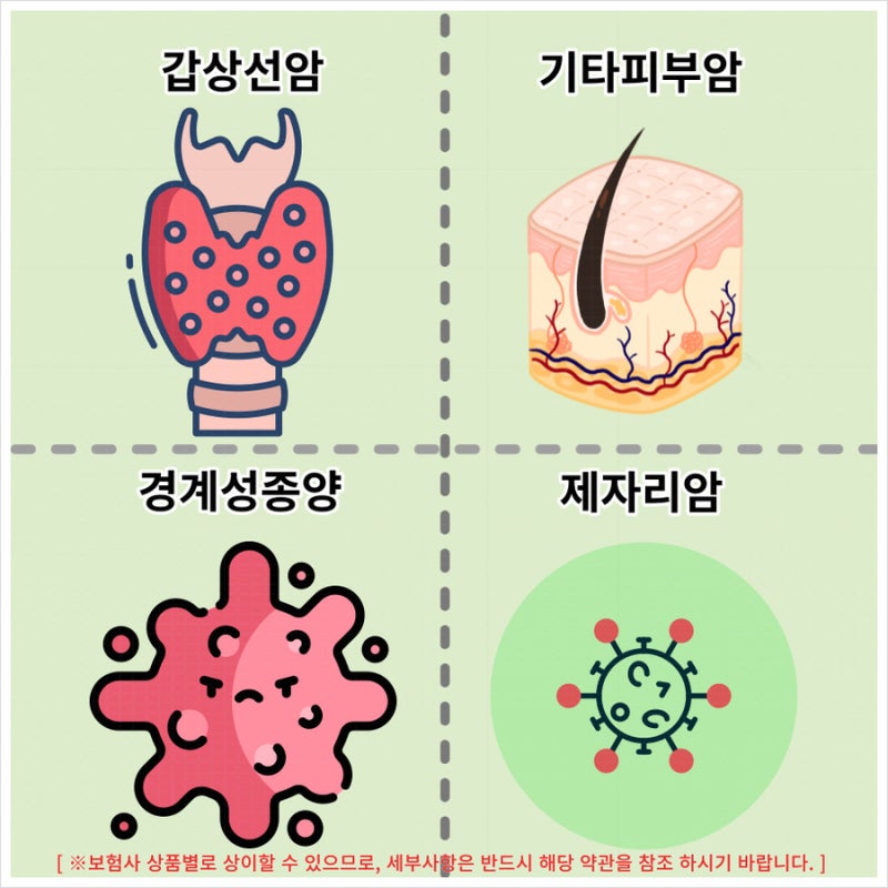 일반암종류 유사암 종류 4가지 알아보기 네이버 블로그
