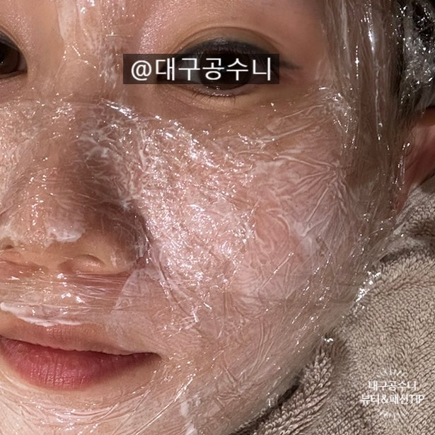 부산 스킨보톡스 후기 효과 통증 부작용 주기 가격 멍 엠보 네이버 블로그