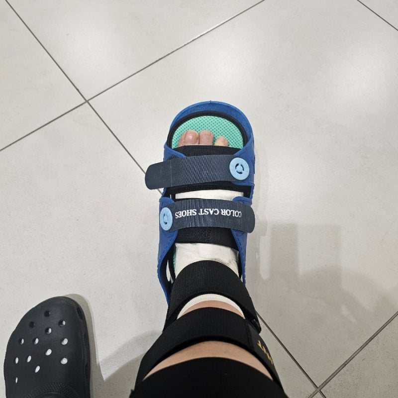 새끼발가락 골절 후 철심 수술 뒤 완치 증상 네이버 블로그