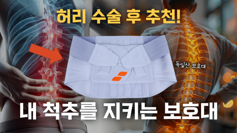 영상리뷰 독일산 척추보호대 허리보호대 허리수술후 추천하는 버터브래딘 라이트 요추전만 허리보호대 네이버 블로그