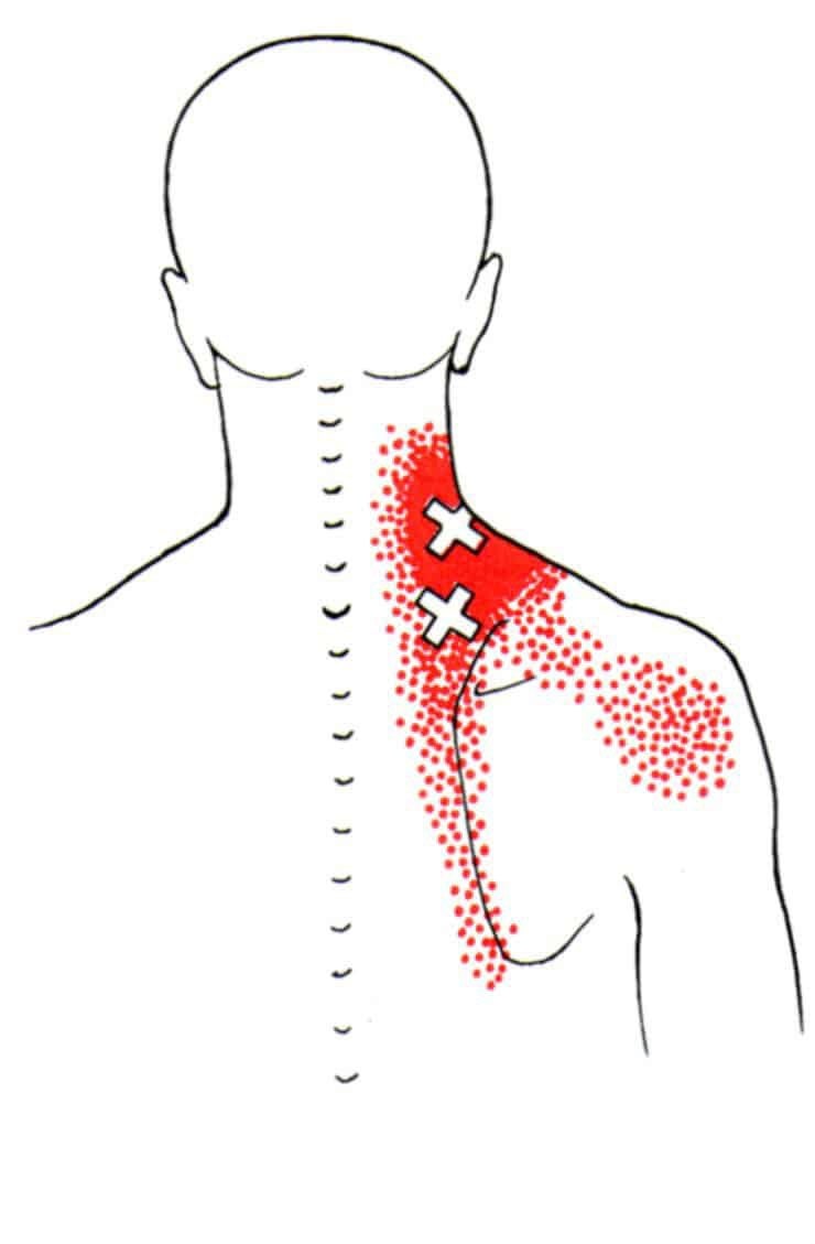 왼쪽 날개뼈 통증 원인과 95 개선할 수 있는 스트레칭 방법 네이버 블로그