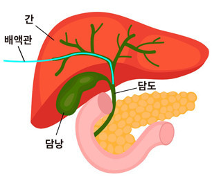 ERBD, ERCP, ENBD, PTBD, PTGBD 비교 총 정리 : 네이버 블로그
