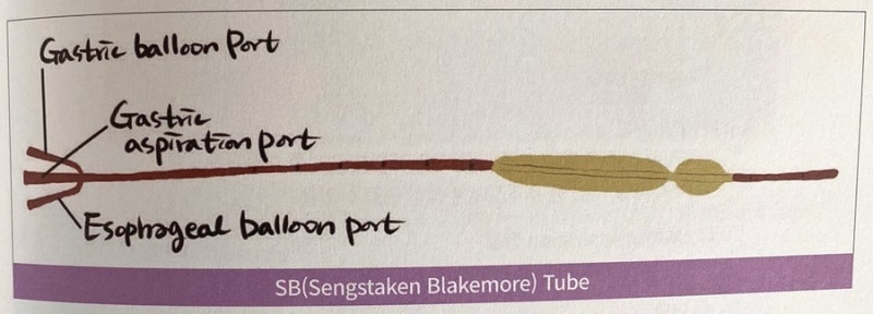 [응급실간호] GI Varix bleeding, 식도정맥류 출혈, SB - tube 총정리 : 네이버 블로그